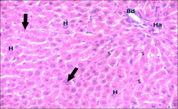 Changes in Rats’ Liver Structure Induced By Zinc Oxide Nanoparticles ...